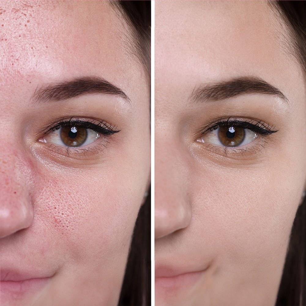 Cum să scapi de punctele negre? | MakeupShop.ro